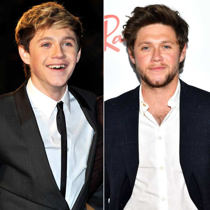 Former One Direction Members: Where Are They Now?