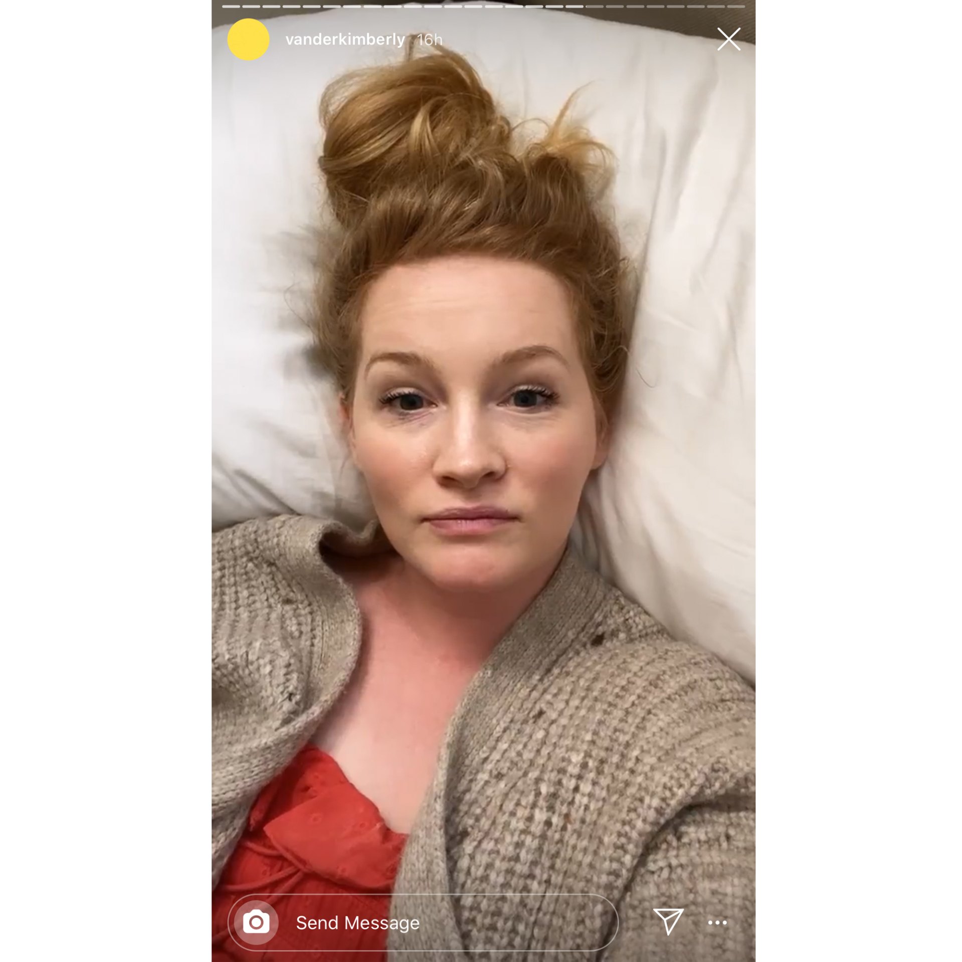 Kimberly Van Der Beek Is ‘Still Healing’ From Blood Transfusions | Us ...