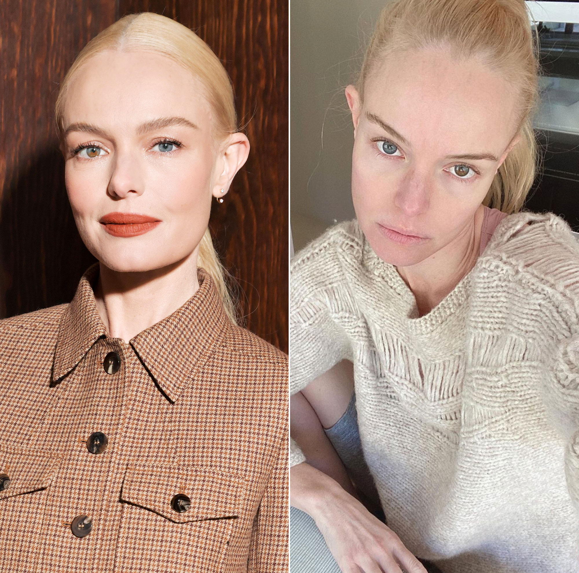 Natural Beauty: Stars Without Makeup | Us Weekly