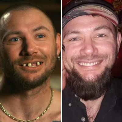 John Finlay Shares Details About His New Teeth, Debunks Rumors | Us Weekly