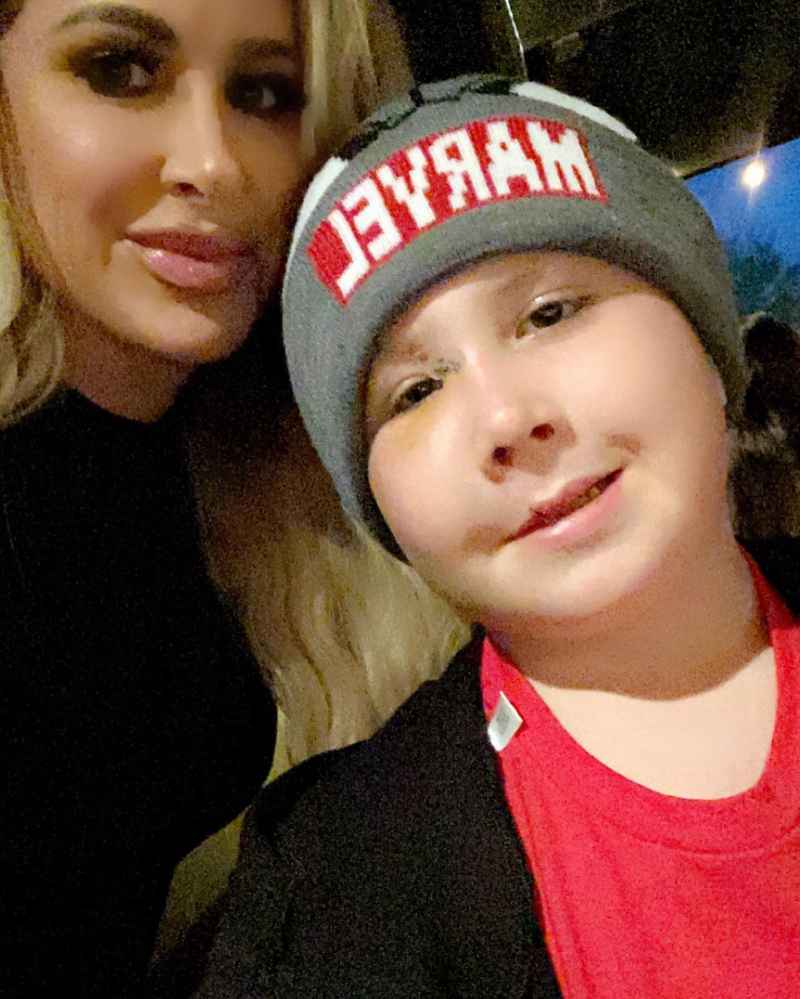 Kim Zolciak Reveals Son Kash Underwent Reconstructive Face Surgery | Us ...