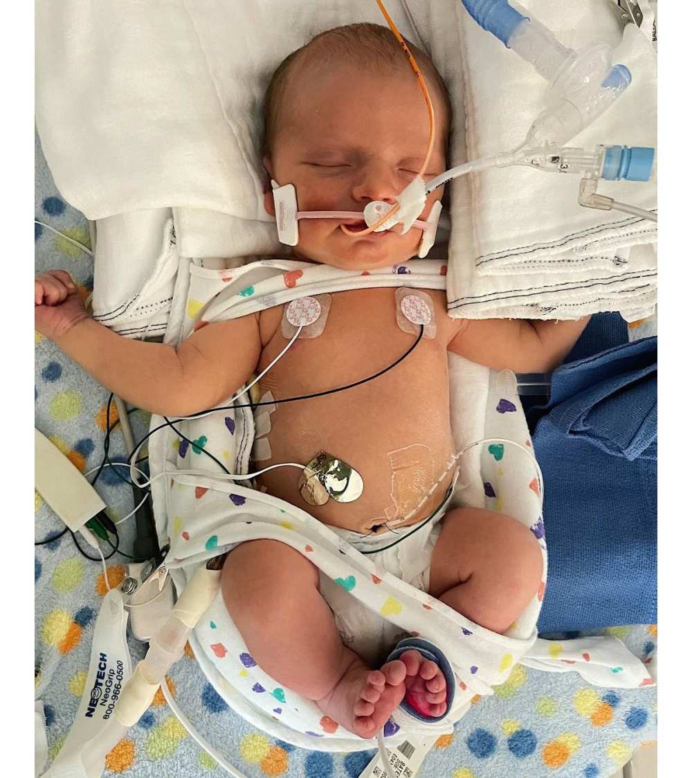 Whitney Bates’ Son Jadon Is ‘Improving’ After Right Lung Collapse | Us ...