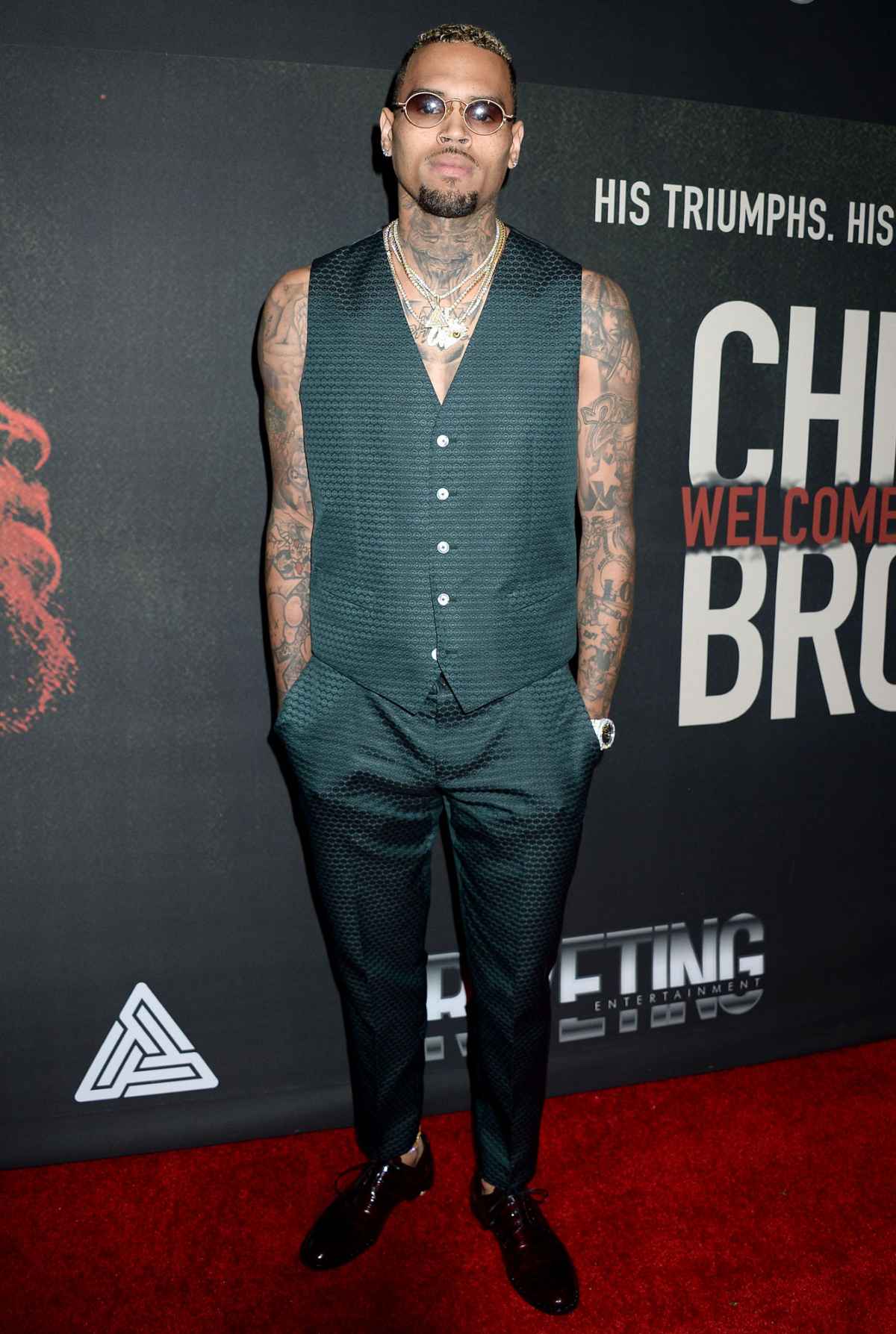 Chris Brown Teeth Fixed