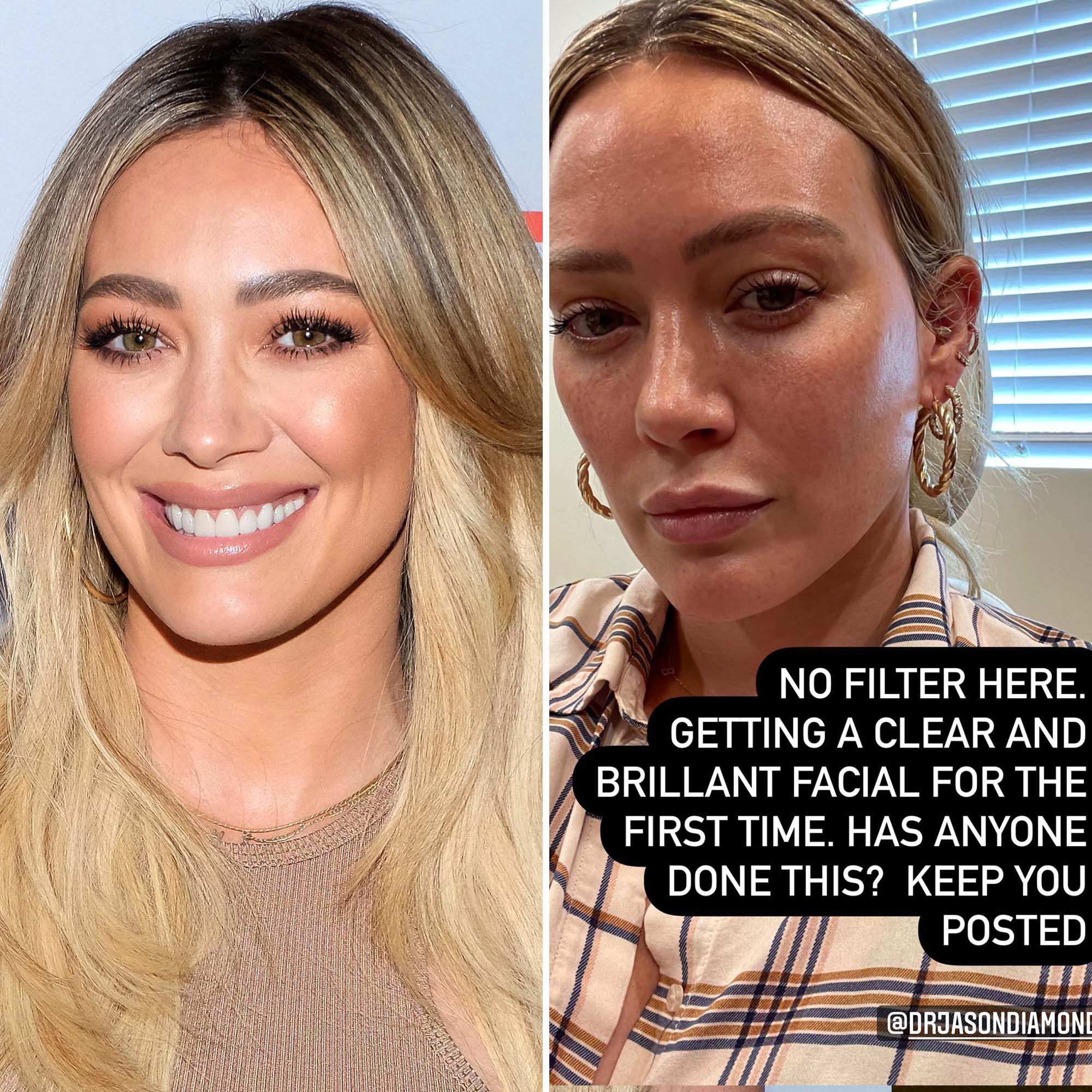 Hilary Duff Without Makeup
