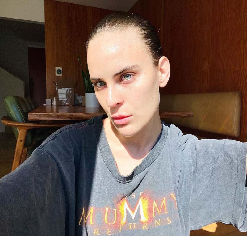 Tallulah Willis Gets Real About Her Skin Transformation | Us Weekly