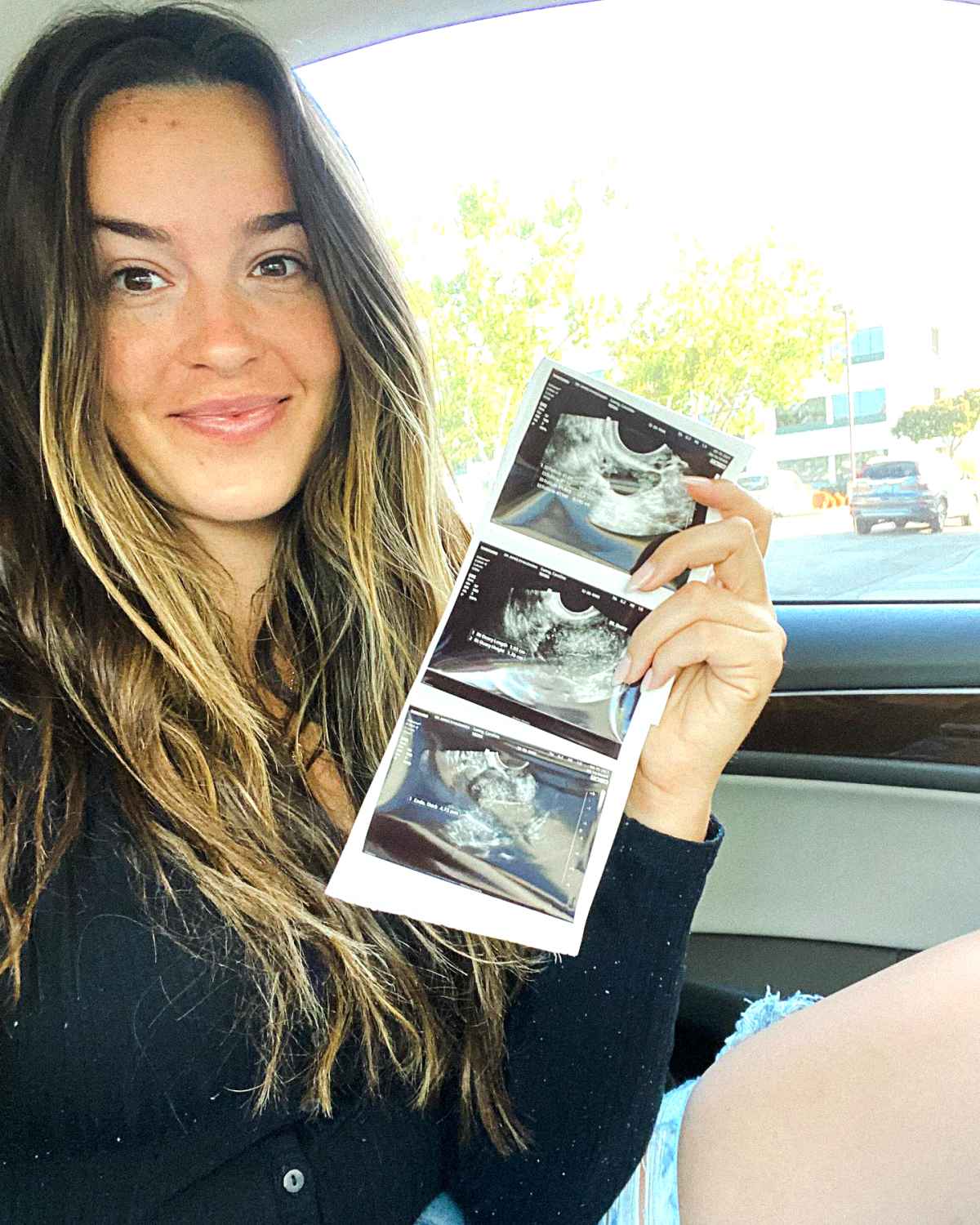 Bachelor’s Caroline Lunny Details Fertility Journey | Us Weekly