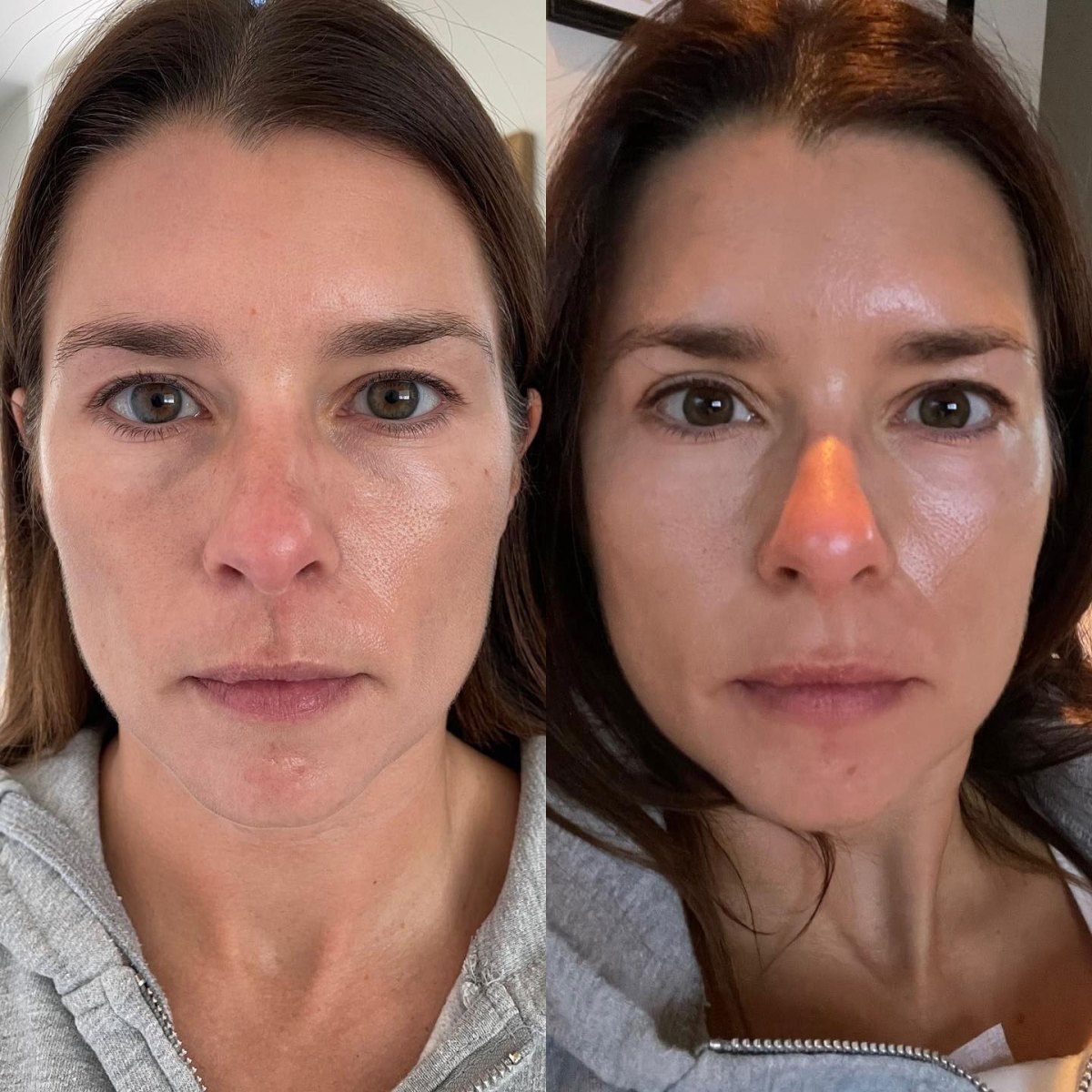 Danica Patrick Has Breast Implants Removed After Illness: Details | Us ...