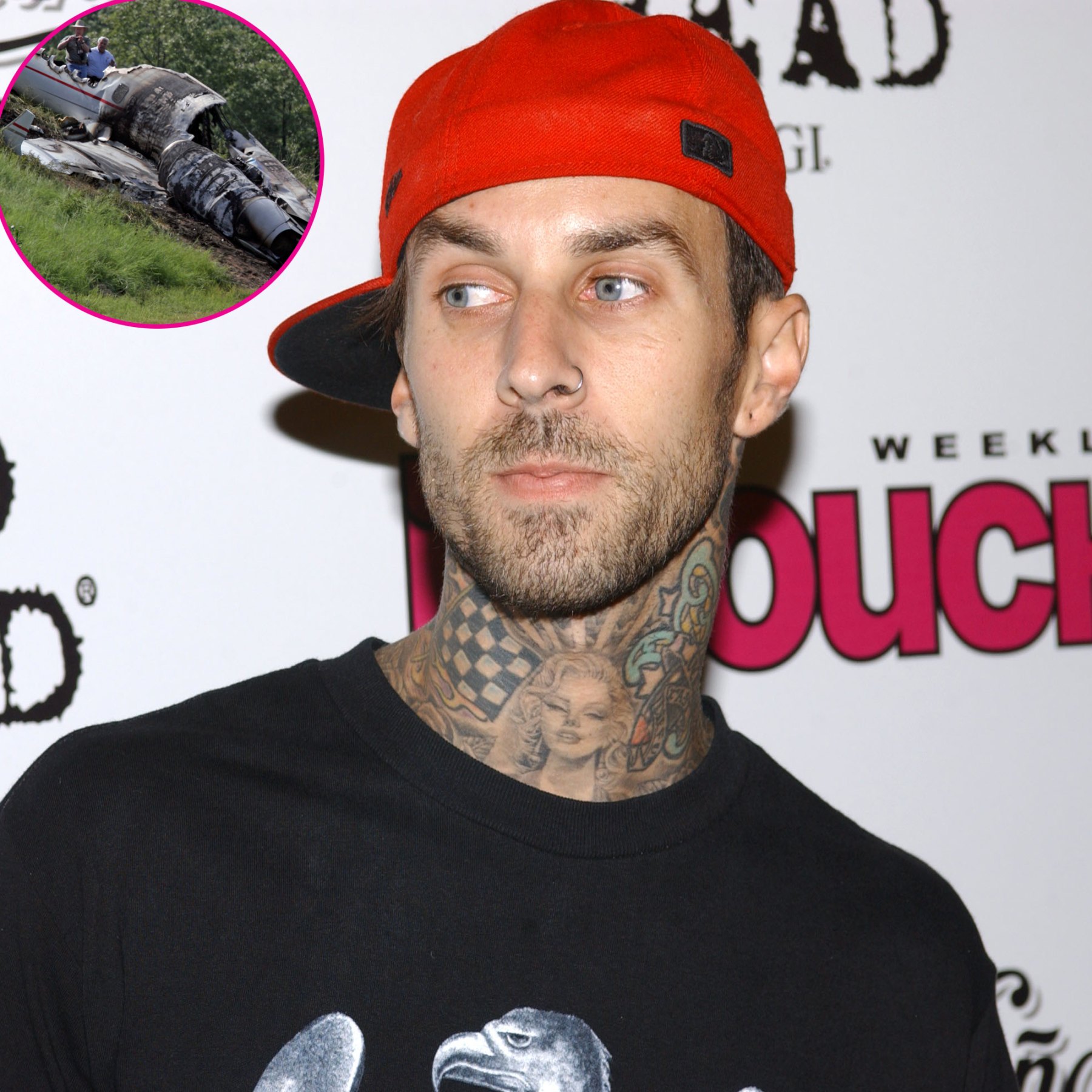 Travis Barker’s Health Scares, Injuries Through the Years | Us Weekly