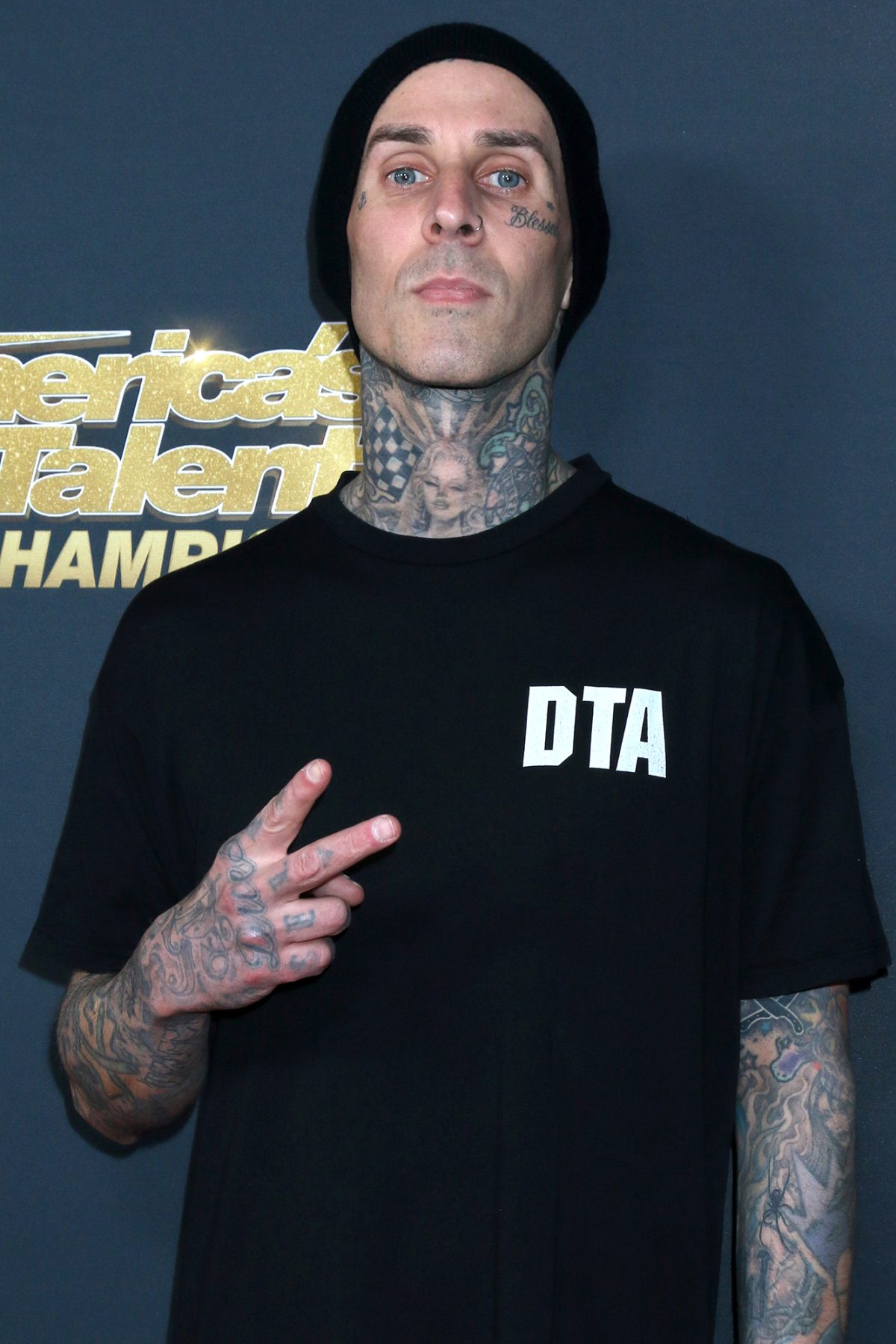 Travis Barker’s Health Scares, Injuries Through the Years | Us Weekly
