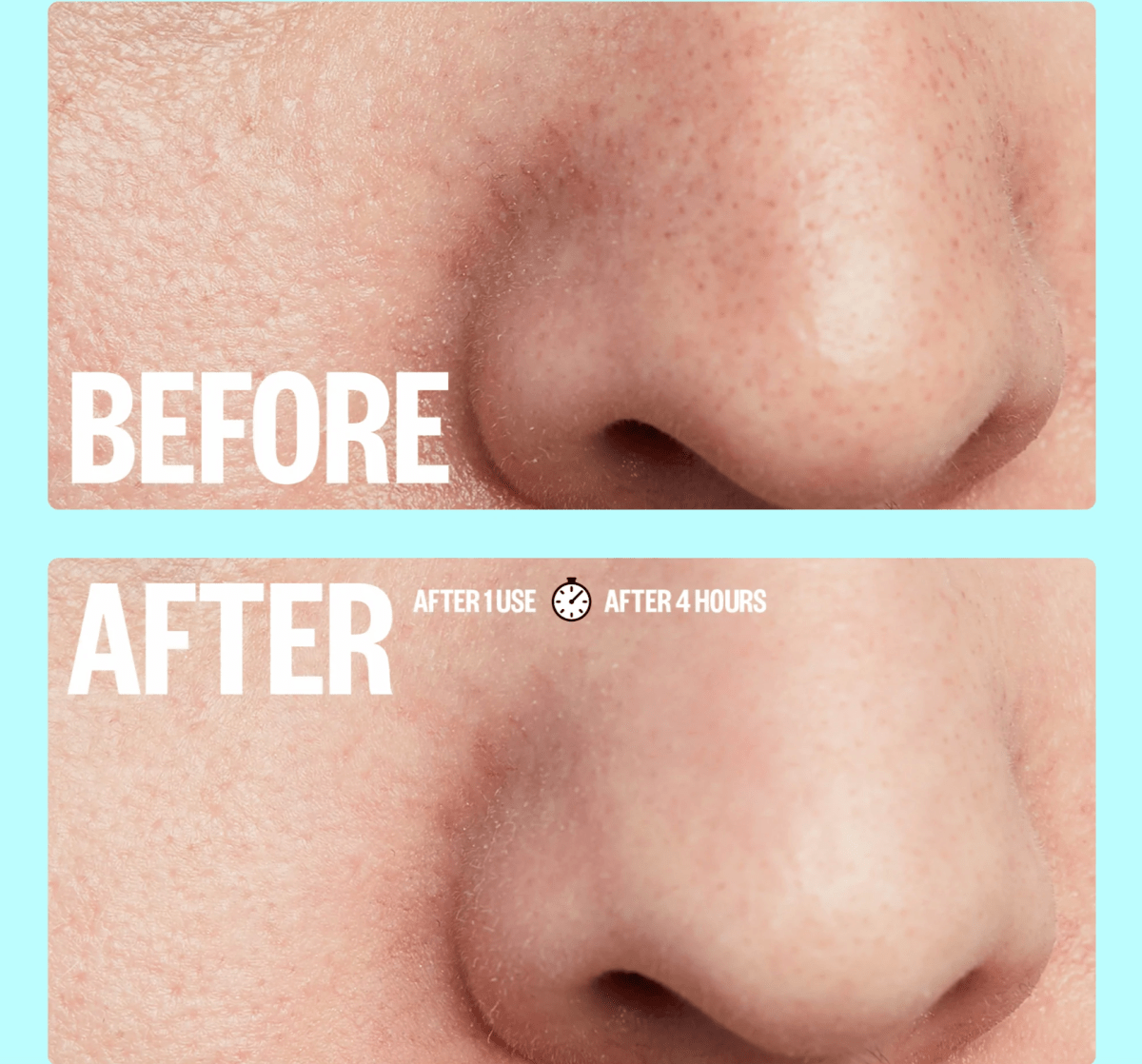 Pore Strips Gross