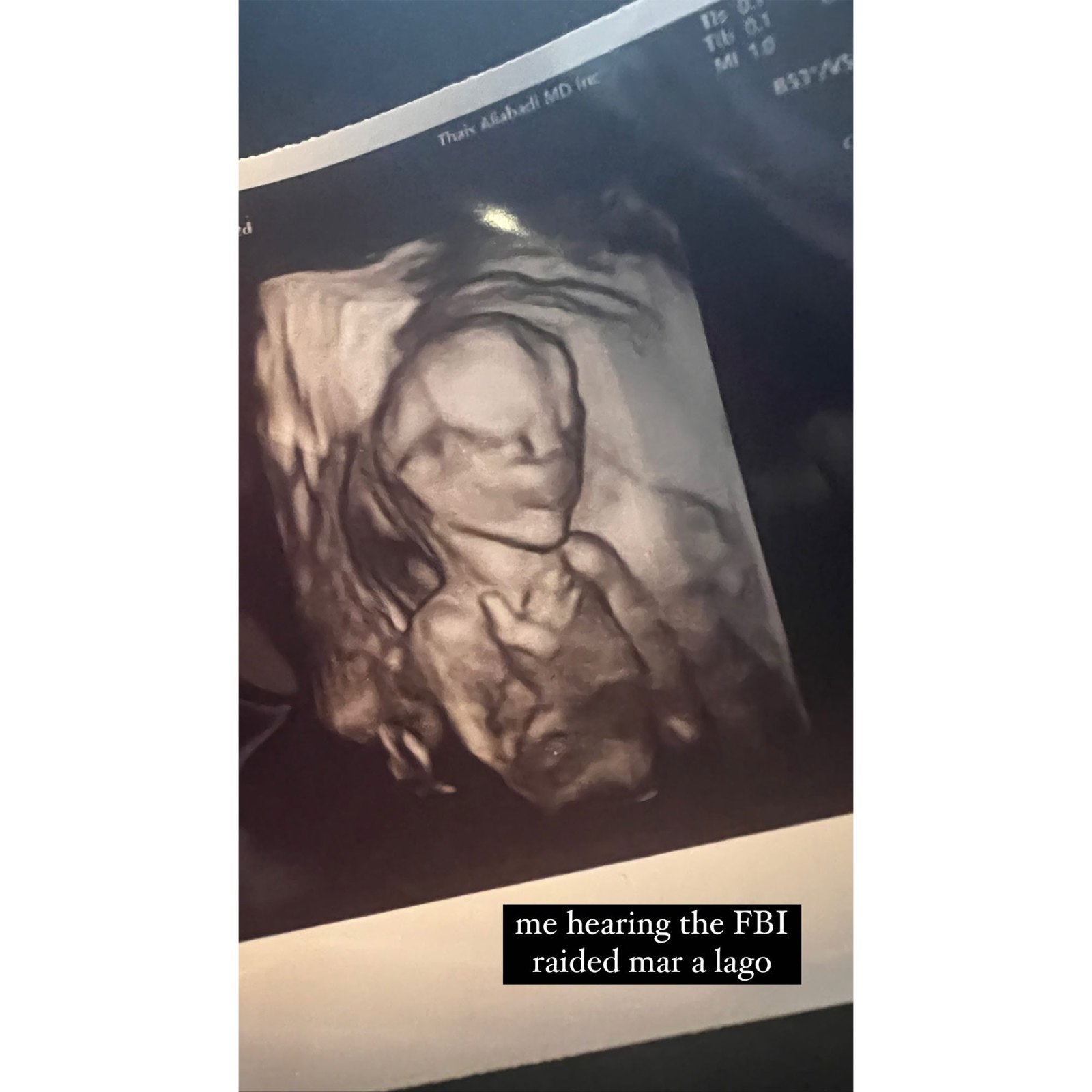 Pregnant Stars Share Ultrasound Pics Ahead of Babies’ Births | Us Weekly