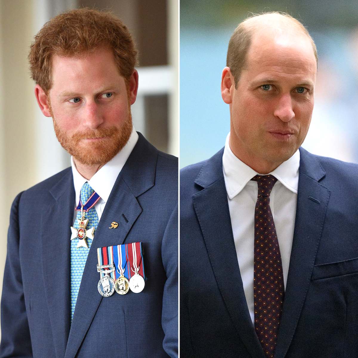 Prince Harry: Prince William Balding Is 'Alarming' and 'Advanced' | Us ...