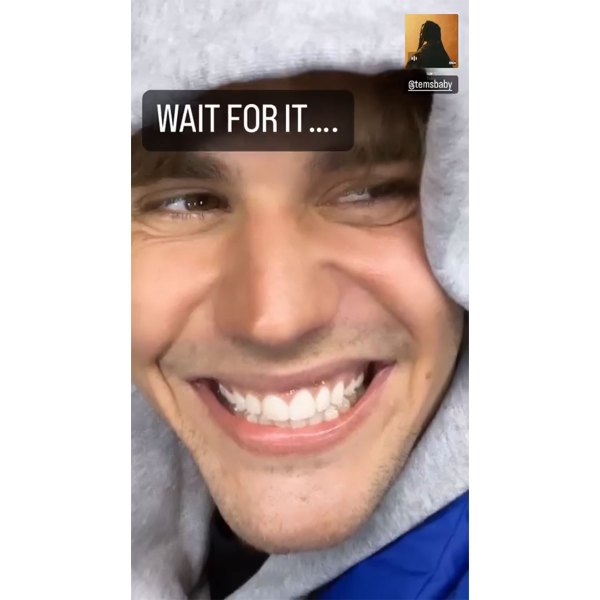 Justin Bieber Shows Off Face Mobility Amid Ramsay Hunt Syndrome | Us Weekly