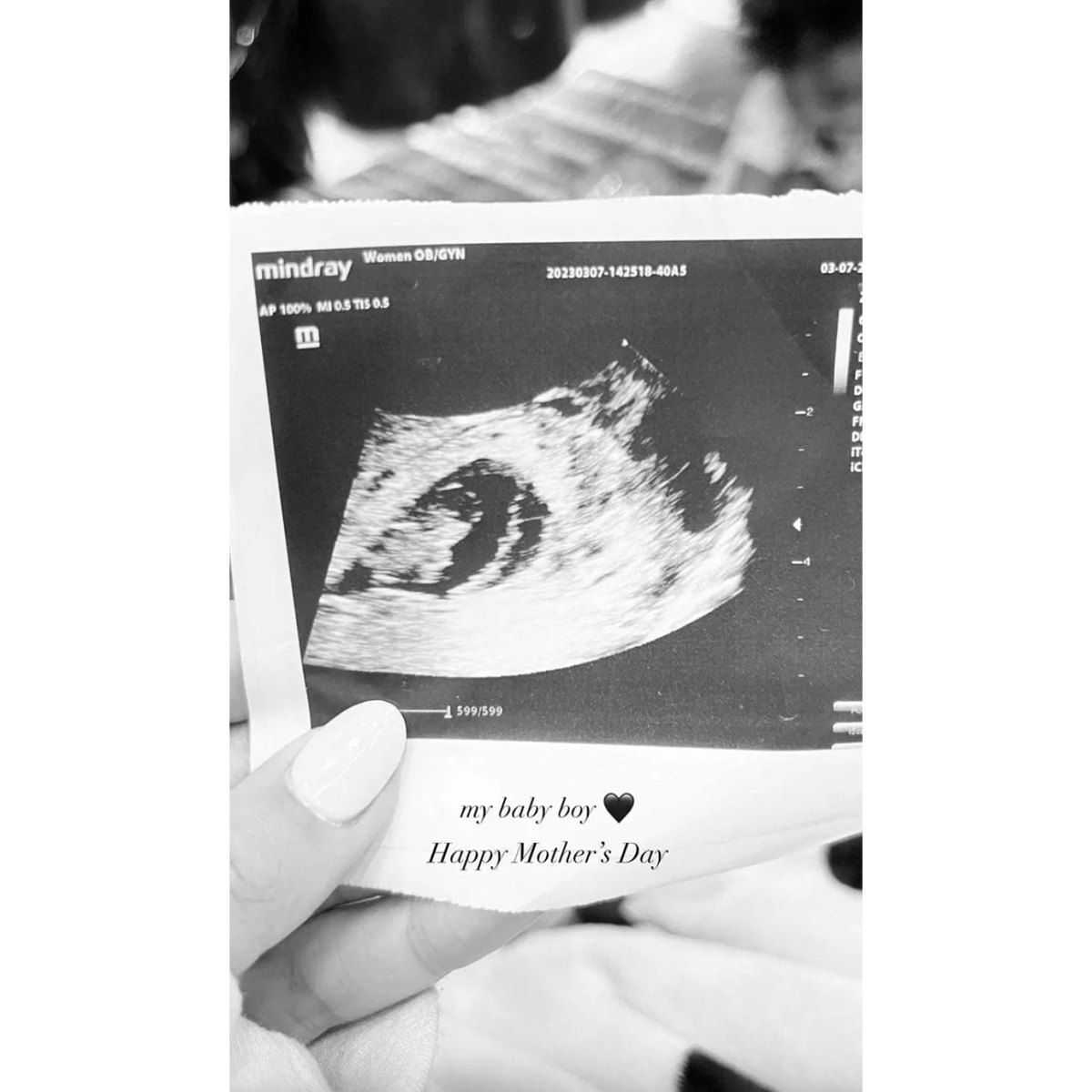 Pregnant Stars Share Ultrasound Pics Ahead of Babies’ Births