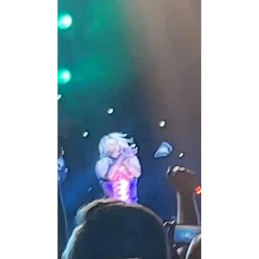 Bebe Rexha Shares Black Eye Pics After Fan Throws Phone at Her | Us Weekly
