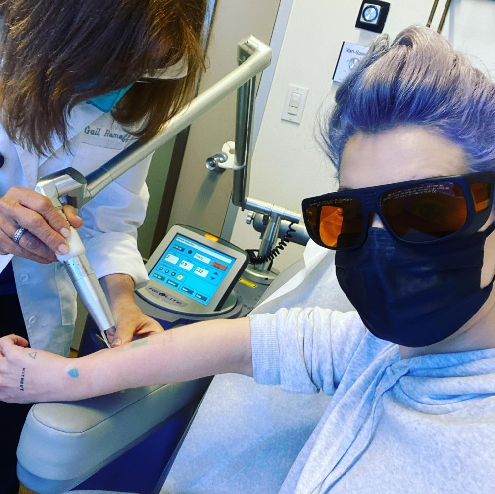 Celebrities Who’ve Had Their Tattoos Removed | Us Weekly
