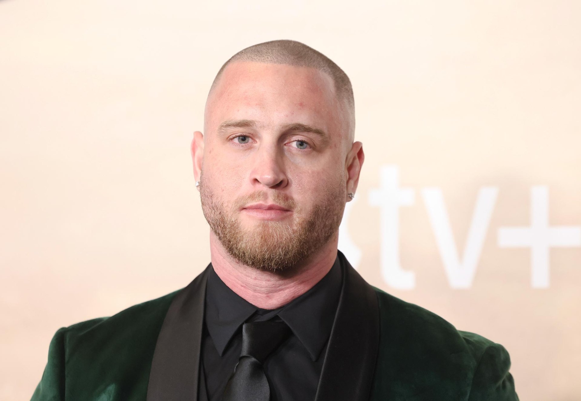 Tom Hanks’ Son Chet Hanks Got His Forehead 'Blasted With Botox' | Us Weekly