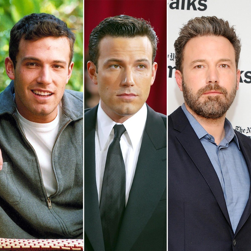 Ben Affleck Hairy Ben Affleck Hair: Is Ben Affleck Bald?