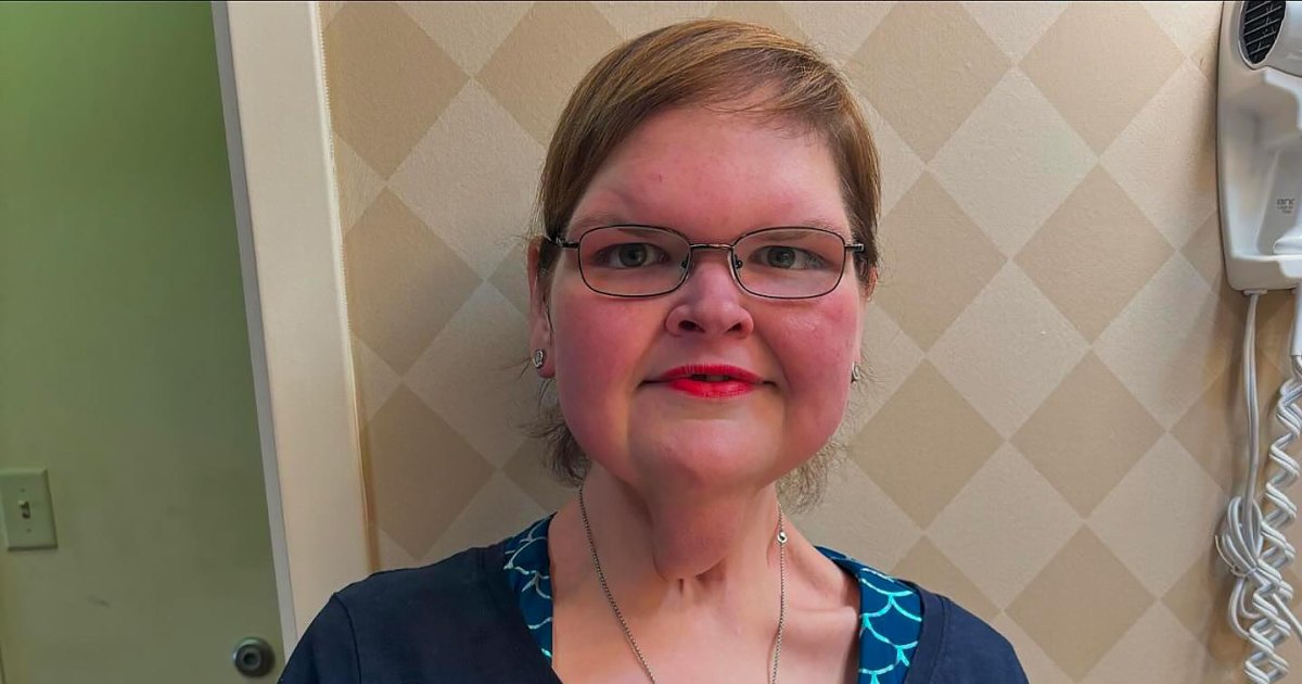 1000 Lb Sisters Star Tammy Slaton Wants Skin Removal Surgery 1000 Lb Sisters Star Tammy Slaton Wants Skin Removal Surgery