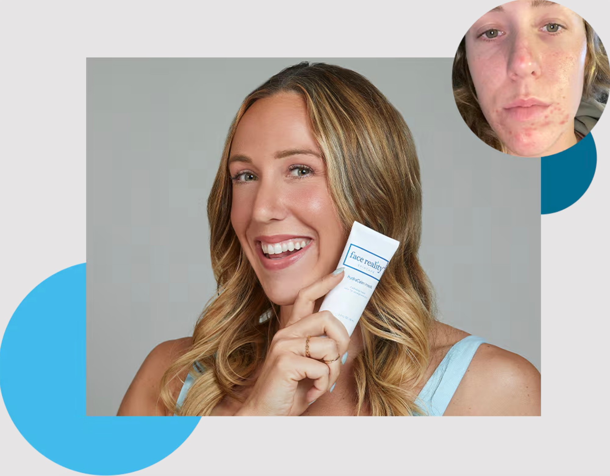 Face Reality Skincare Archives - Us Weekly