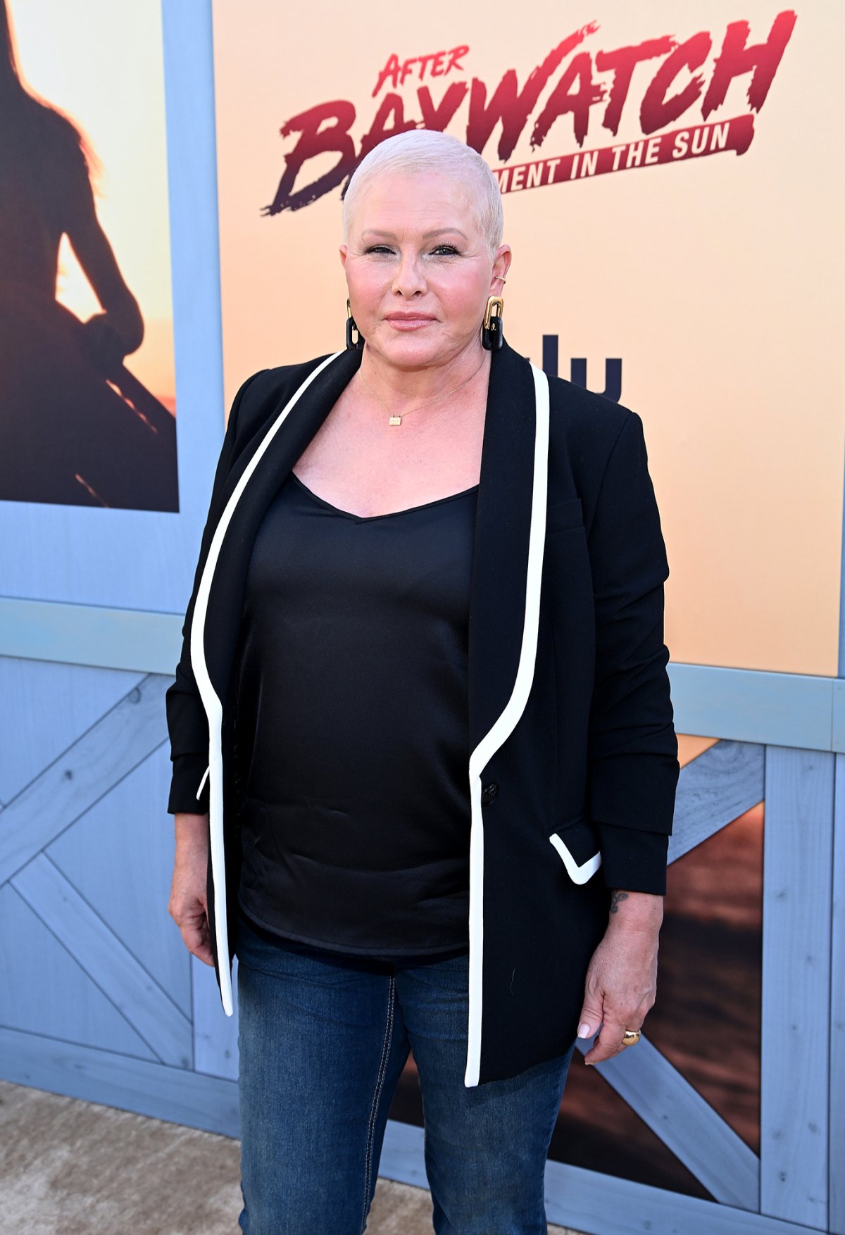 Baywatch's Nicole Eggert Details 'Waiting Period' of Cancer Battle | Us ...