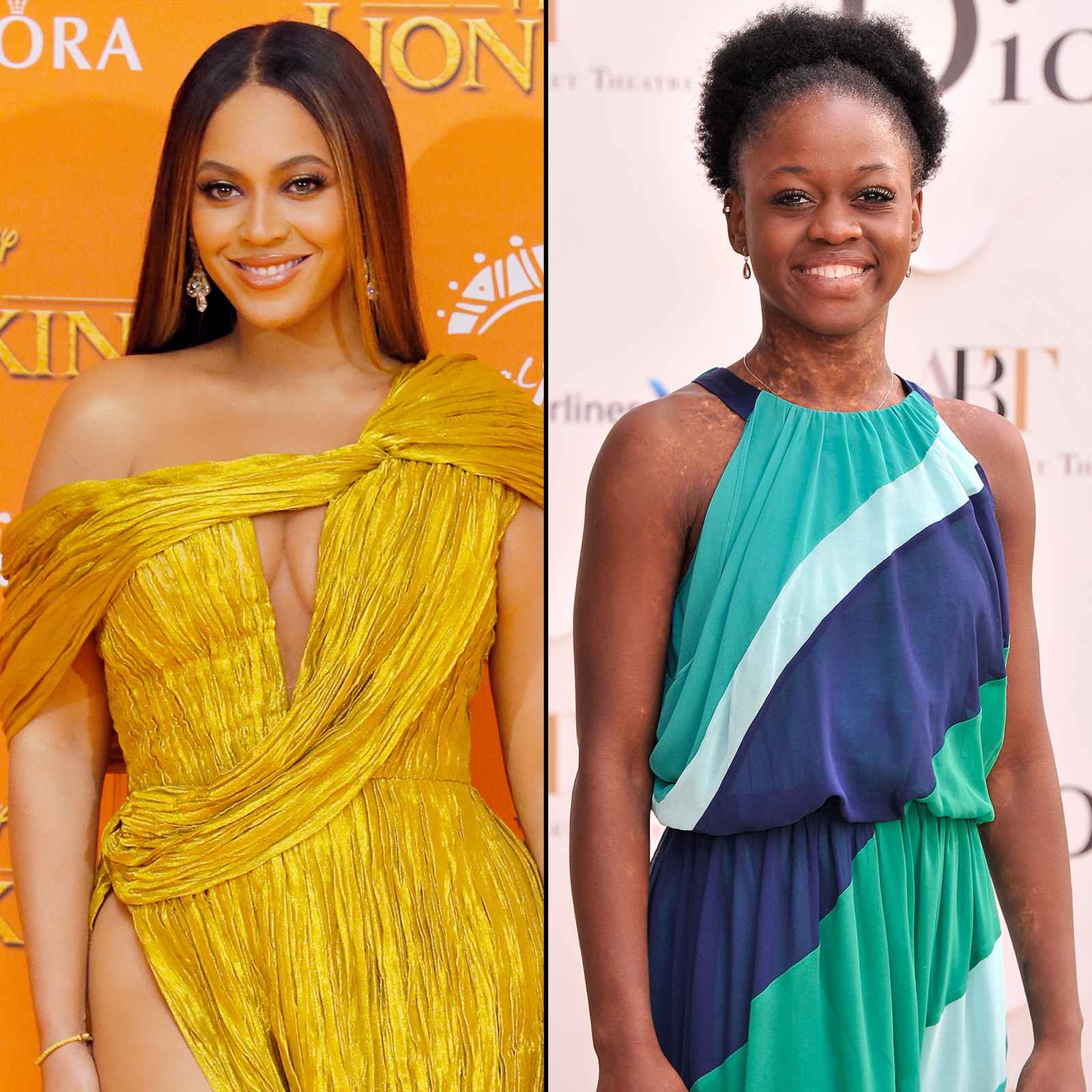 Beyonce Once Called Michaela DePrince a 'Creature From Another Planet ...