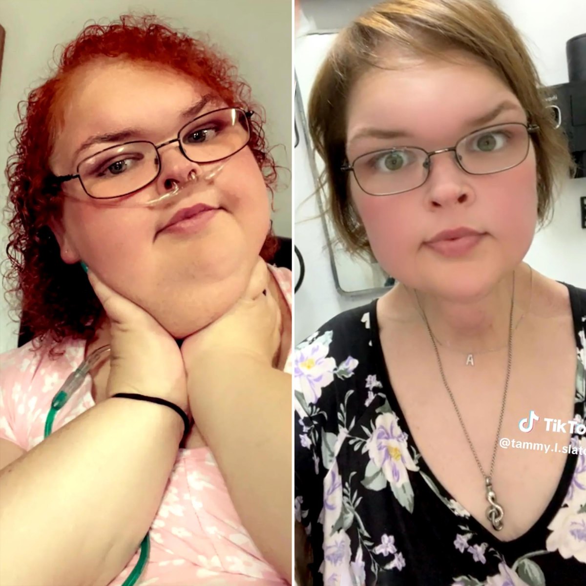 Celebrities' Weight Loss Transformations: Photos of Jelly Roll and More ...