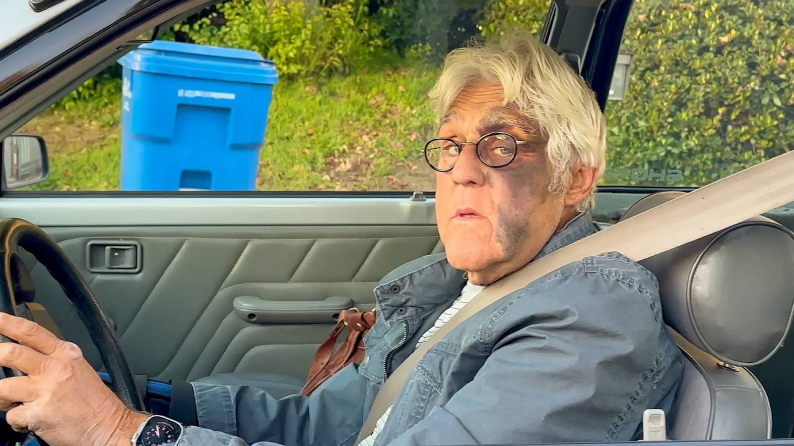 Jay Leno Spotted With Bruise Taking Up Half His Face | Us Weekly