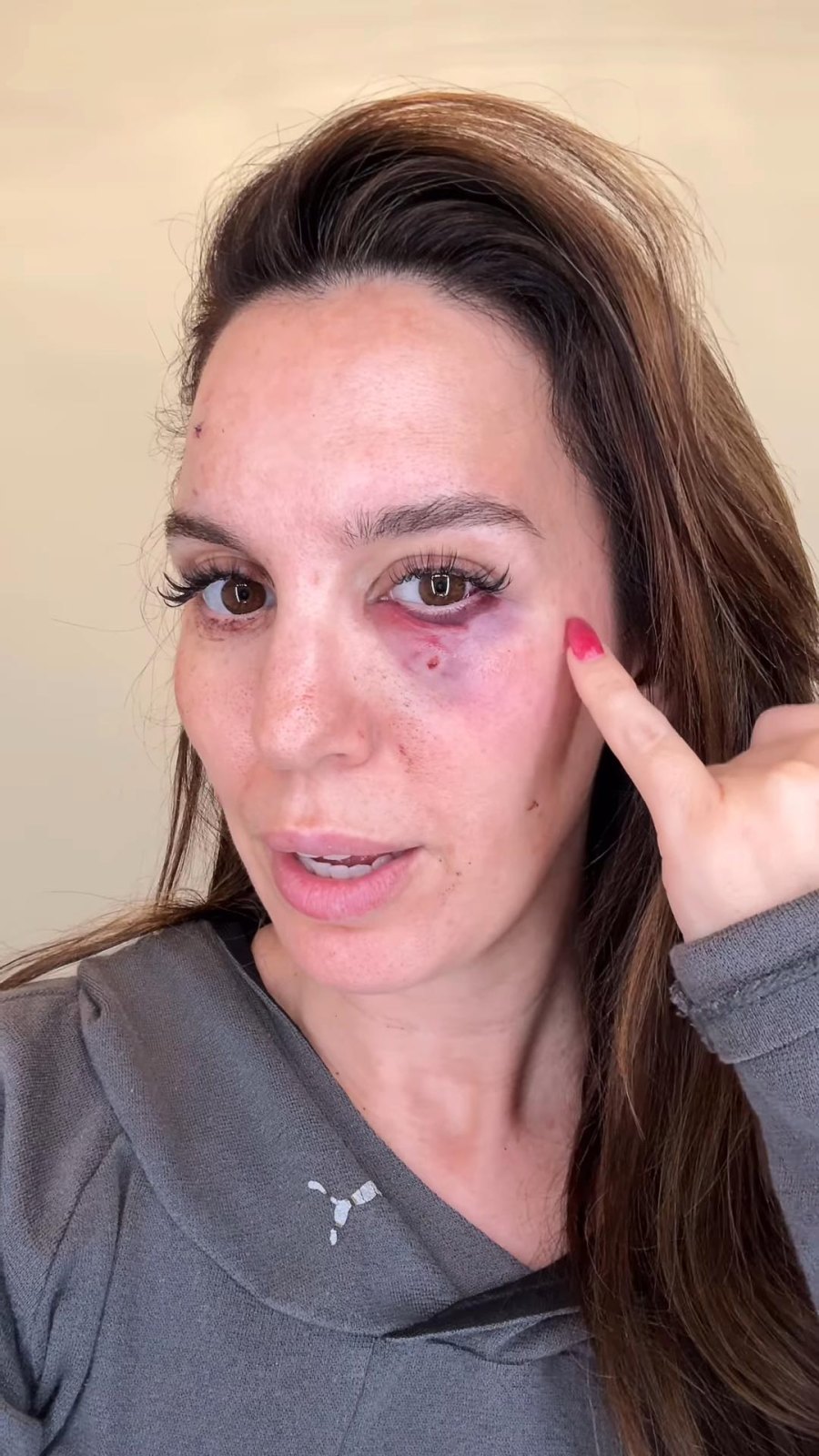 Christy Carlson Romano Allegedly Shot in the Eye on Husband’s Birthday ...