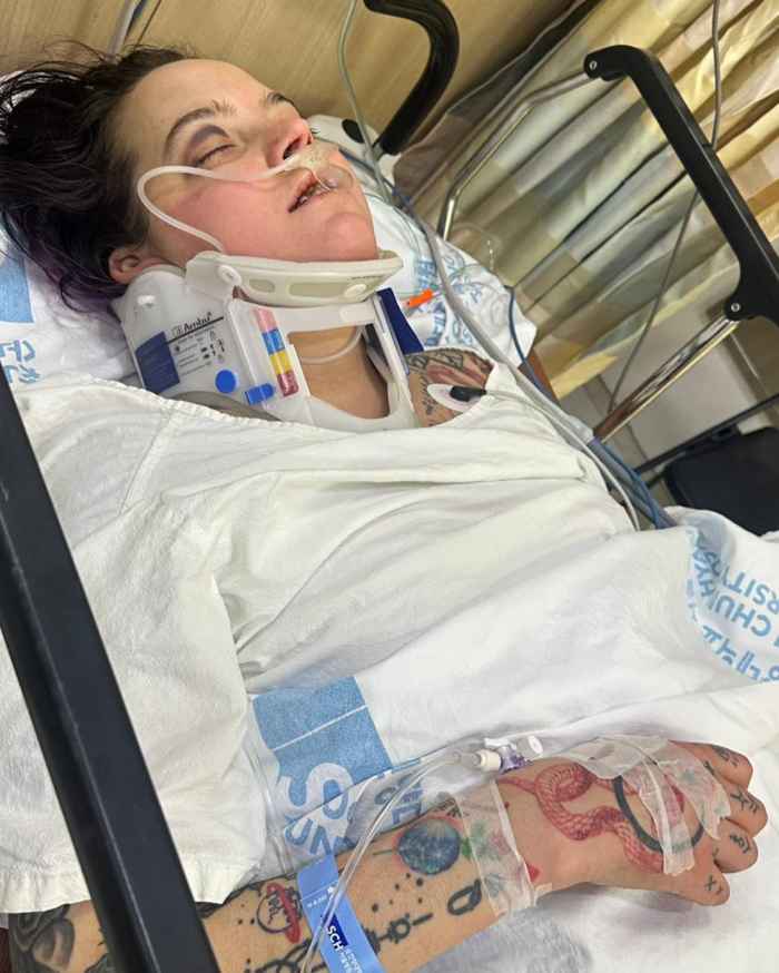 Influencer Ashley Surcombe Back in ICU After Contracting Pneumonia | Us ...