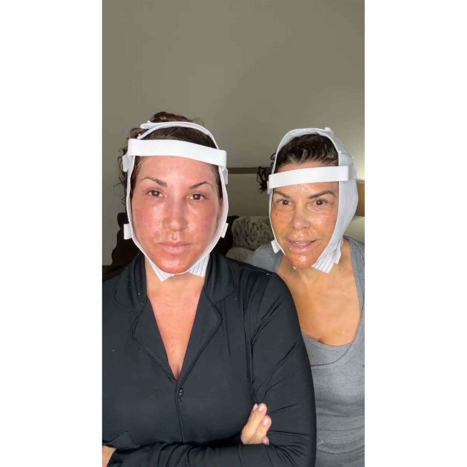 Real Housewives Stars Jacqueline Laurita and Lynne Curtin Facelift ...