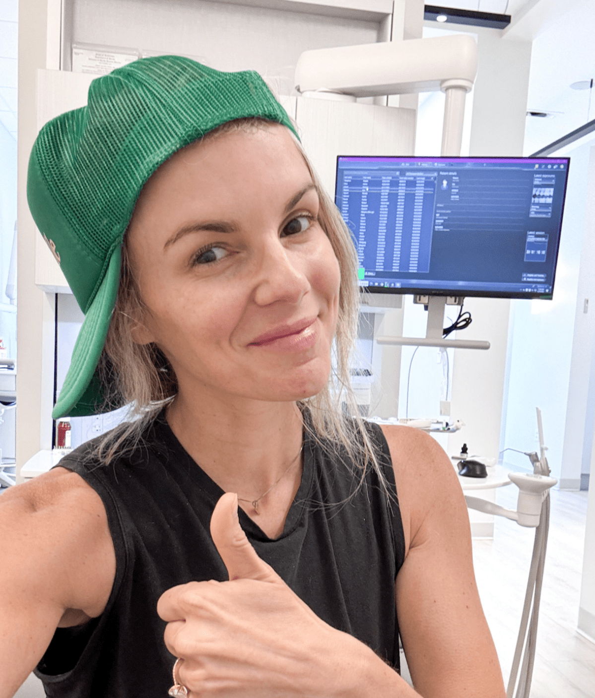 Ali Fedotowsky Loses Tooth at Dinner, Shares the Funny Story | Us Weekly