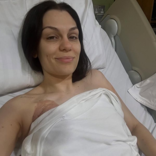 Jessie J Reveals Breast Cancer Is 'All Gone' After Surgery | Us Weekly