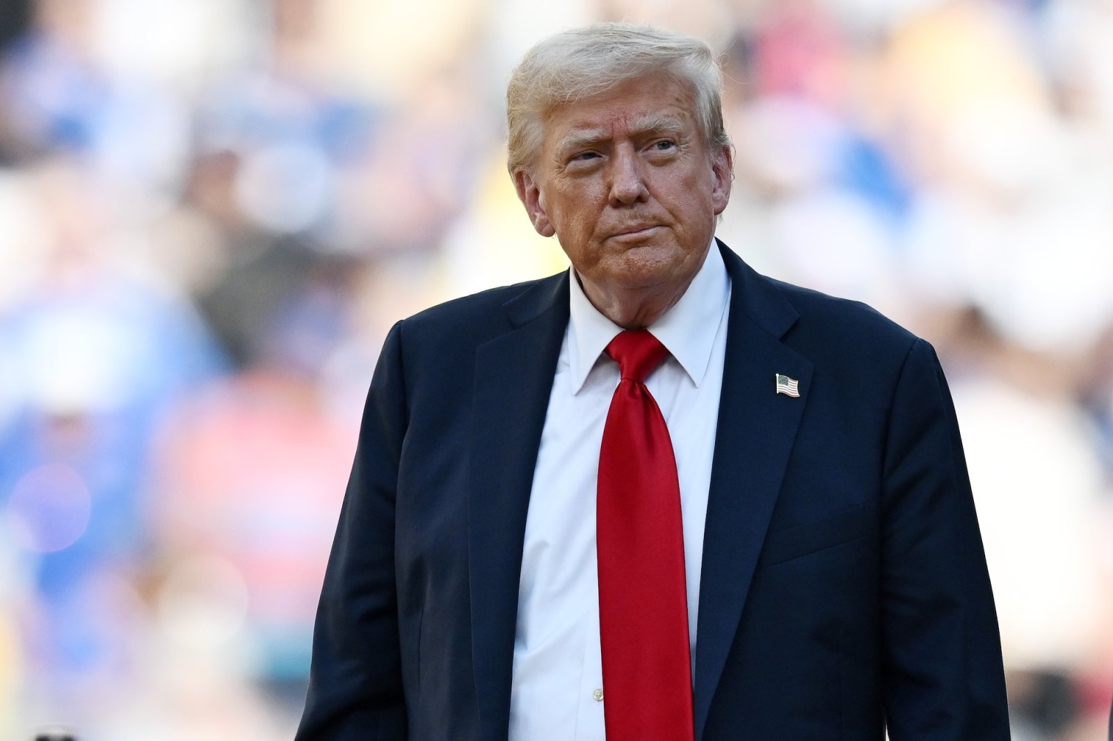 Donald Trump Diagnosed With Common Vein Condition After Swelling | Us ...