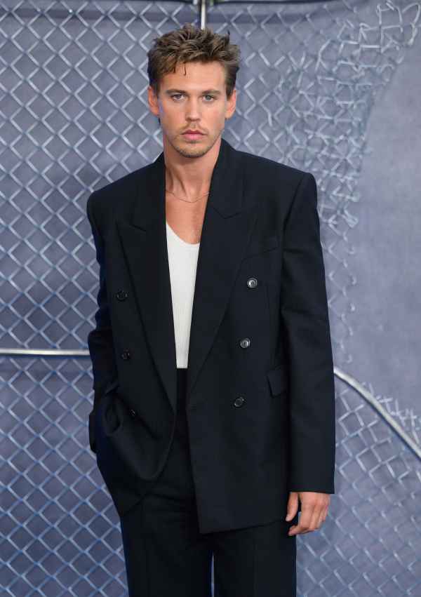 Austin Butler Injured by Pitbull During Once Upon a Time Scene | Us Weekly