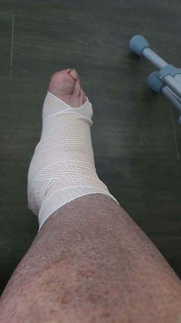 Barstool's Frank the Tank Hospitalized After Blood 'Shooting' From Foot ...