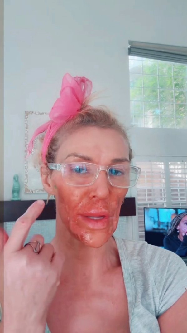 Brandi Glanville's Health Battle: Facial Disfigurement, Diagnosis, More ...