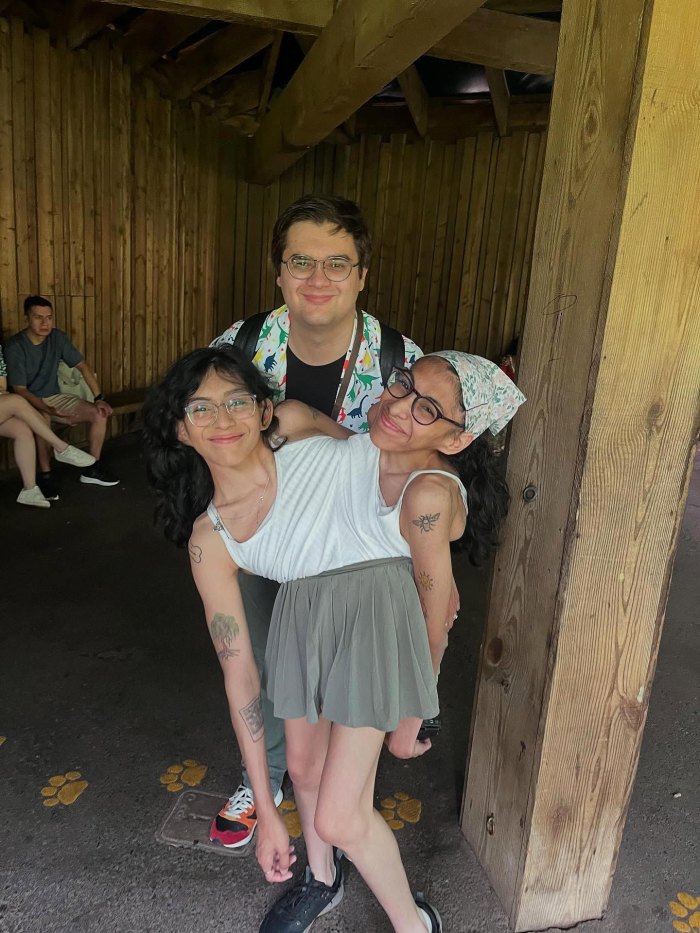 Conjoined Twins Carmen and Lupita Andrade on How They Navigate Intimacy ...