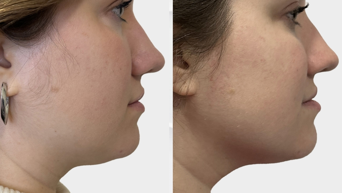 SickScience Labs Archives - Us Weekly