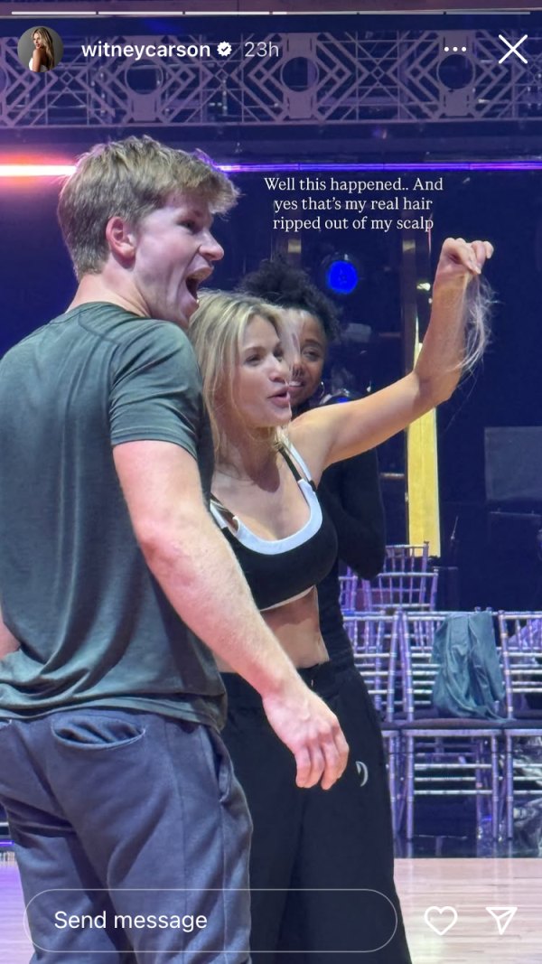 Witney Carson Lost Hair Clump in Dancing With the Stars Finale Practice ...