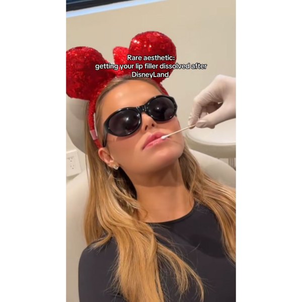 Brooks Nader Gets Lip Filler Dissolved as Christmas Gift to Her Parents ...