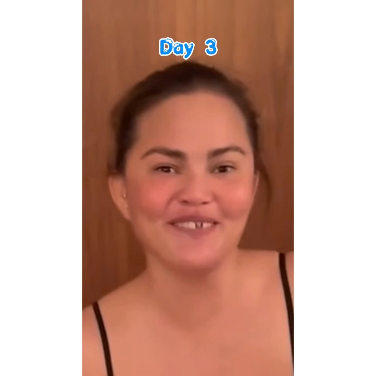 Chrissy Teigen Knocks Out Her Own Front Tooth in Candy Cane Mishap | Us ...