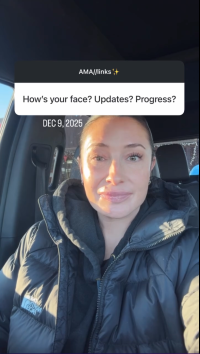 Bristol Palin Shares Update on Facial Paralysis After 300 Days | Us Weekly