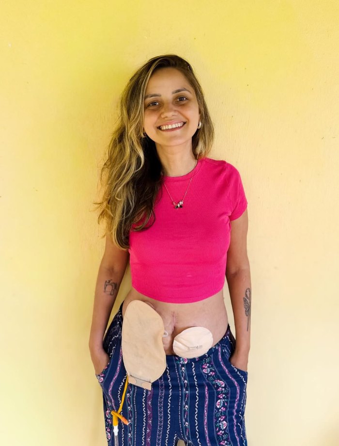 Influencer Jessica Daugirdas muere tras luchar contra la sepsis y el ...