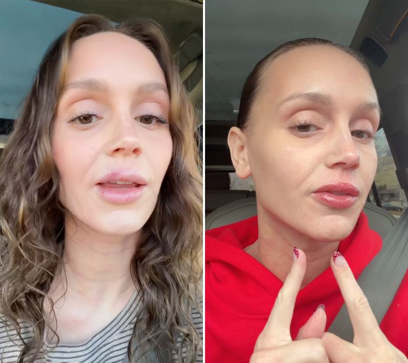 Mormon Wives’ Mikayla Matthews on Why She Dissolved Her Lip Filler | Us ...