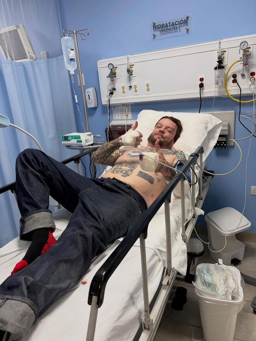 Pawn Stars’ Corey Harrison Hospitalized After Crash, Breaks Ribs | Us ...