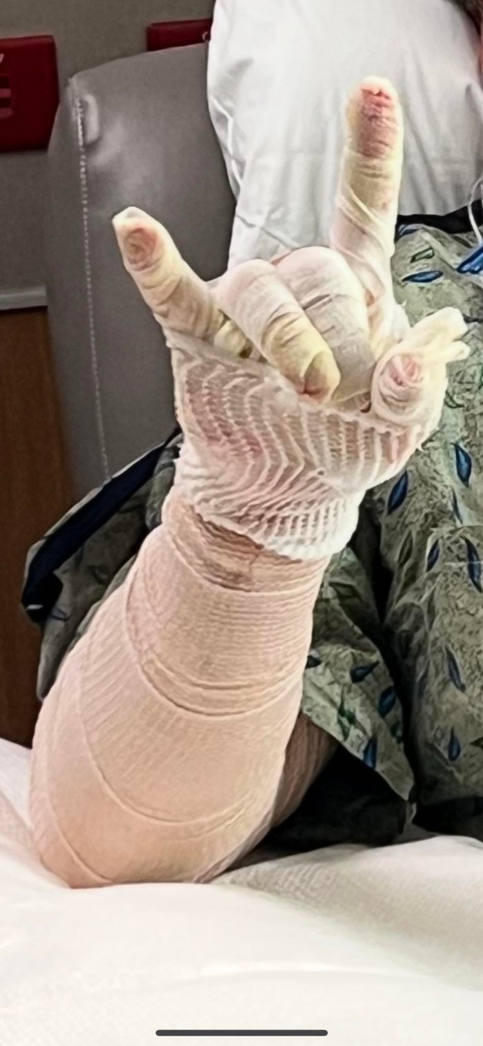 Jordan Shipley’s Sister Posts Photo of His Bandaged Body After Ranch ...