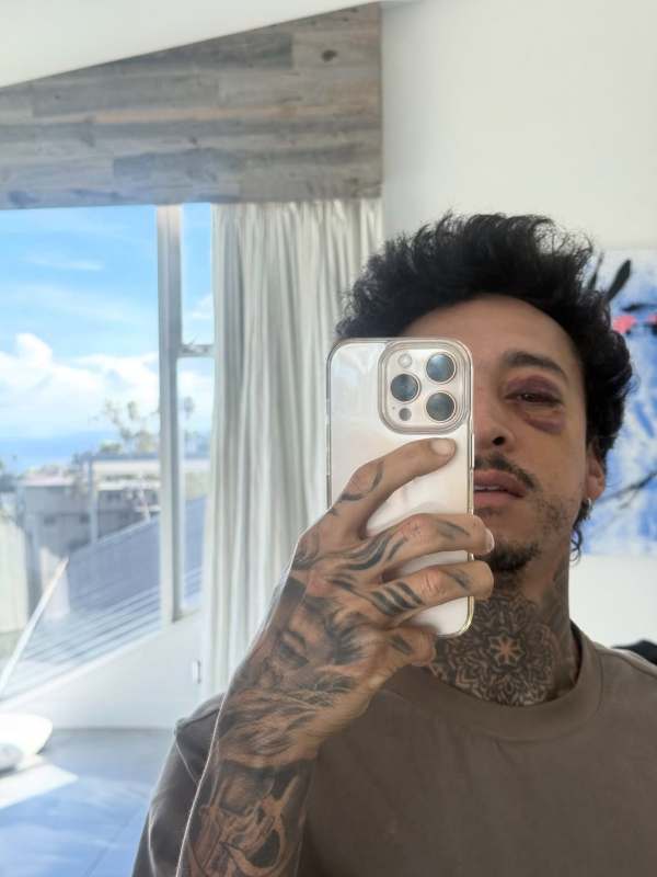 Olympian Nyjah Huston Fractures Skull After ‘Death Defying’ Skateboard ...