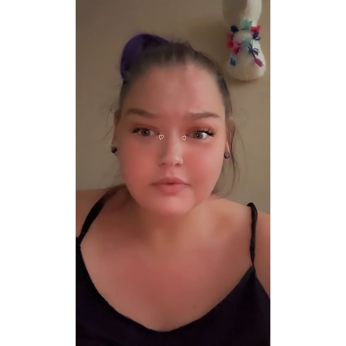 1000-Lb. Sisters' Amy Slaton Shows Off Results After Lazy Eye Surgery ...
