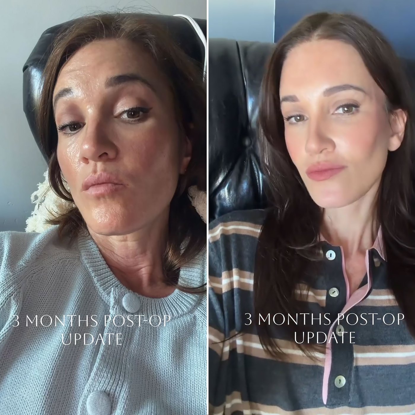 Influencer Katie Anderson Shows Off 2nd Facelift Results at 48: ‘So ...